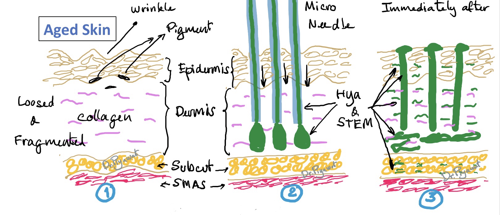 Cell Youth - Piyawat Clinic