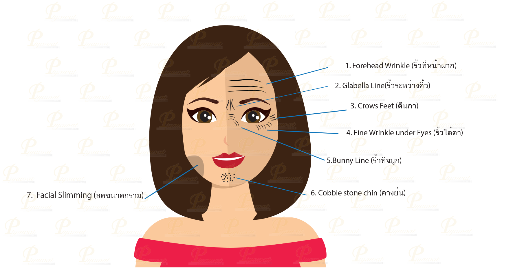 Botox: Natural Looking and Safety Technique - Piyawat Clinic